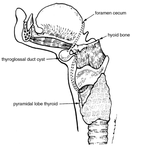 Lump or Mass in the Neck - MPENTA
